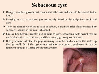 OMFS Neck Swelling g.pptx