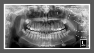TMJ Examination Case History in Dentistry | PPTX