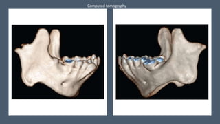 TMJ Examination Case History in Dentistry | PPTX