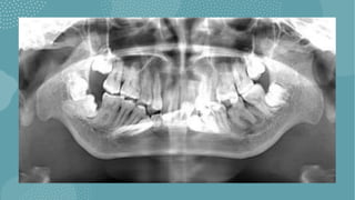 TMJ Examination Case History in Dentistry | PPTX