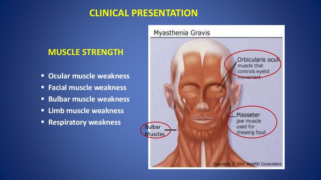 MYASTHENIA GRAVIS