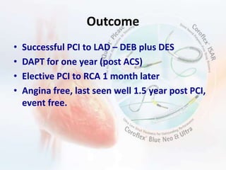 HYBRID DEB AND DES PCI | PPTX