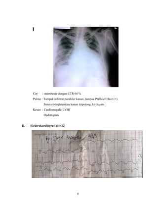 Omi anteroseptal dan hypertension heart disease (hhd) | DOC