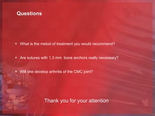 Floating thumb | PPT