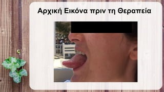 Ομοιοπαθητική και Άγχος, Κρίσεις Πανικού, Ψυχοσωματικά: Περιστατικό 14 ...