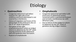 Omphalocele vs gastroschisis | PPTX