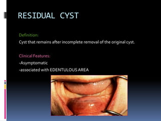 Residual Cyst Clinical