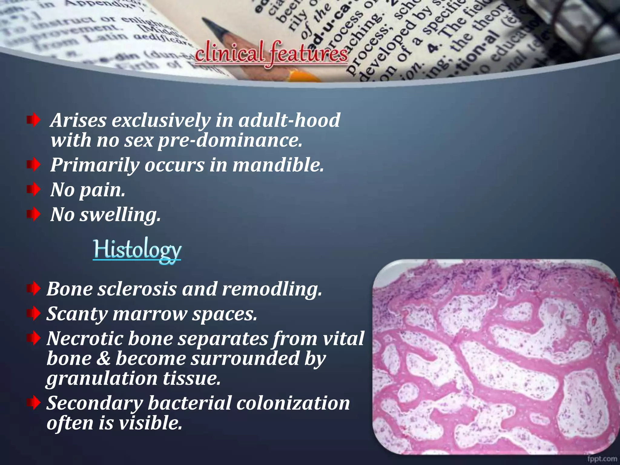 Osteomyelitis of jaw--department of oral medicine and radiology | PPTX