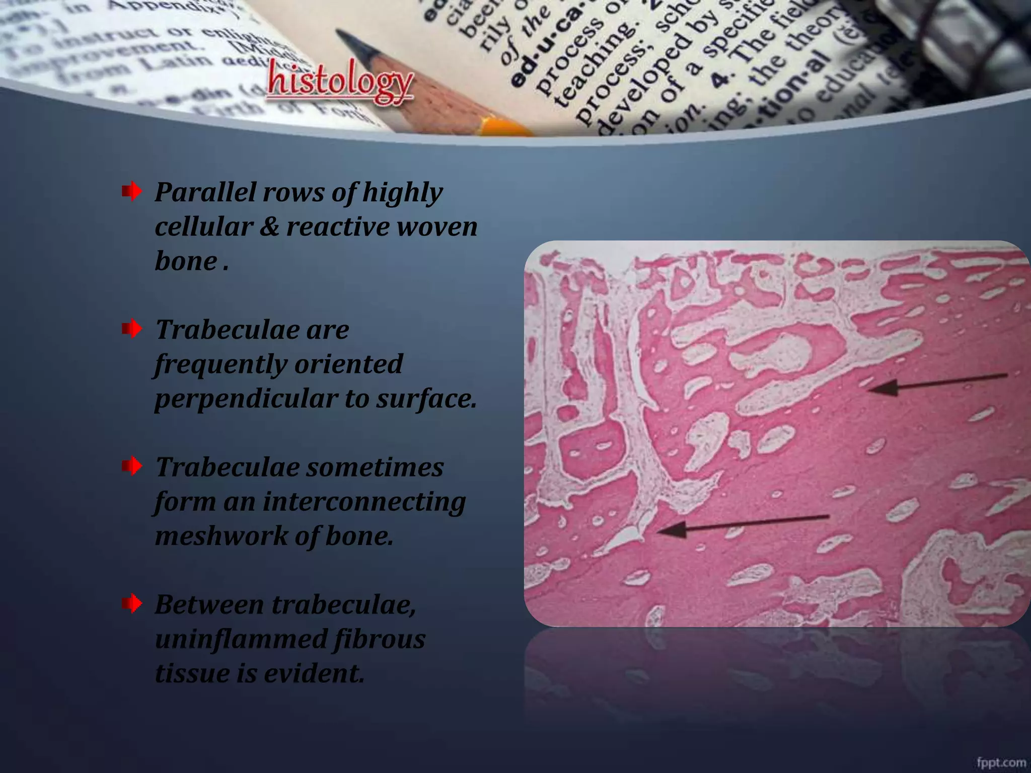 Osteomyelitis of jaw--department of oral medicine and radiology | PPTX