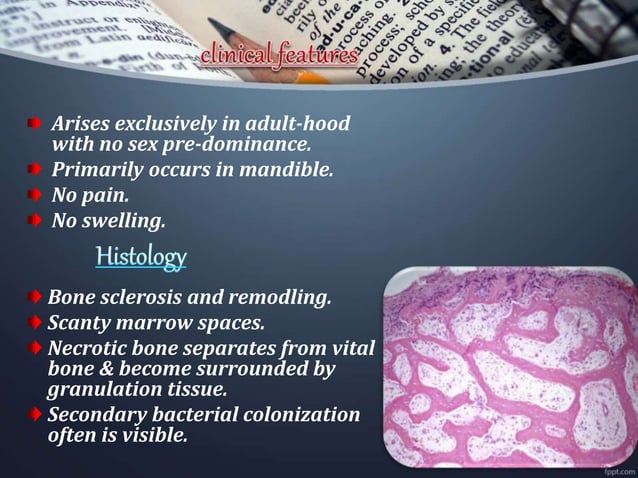 Osteomyelitis Of Jaw Department Of Oral Medicine And Radiology