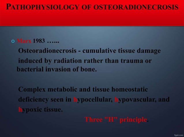 Osteomyelitis Of Jaw Department Of Oral Medicine And Radiology