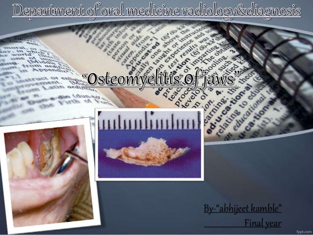 Osteomyelitis Of Jaw Department Of Oral Medicine And Radiology