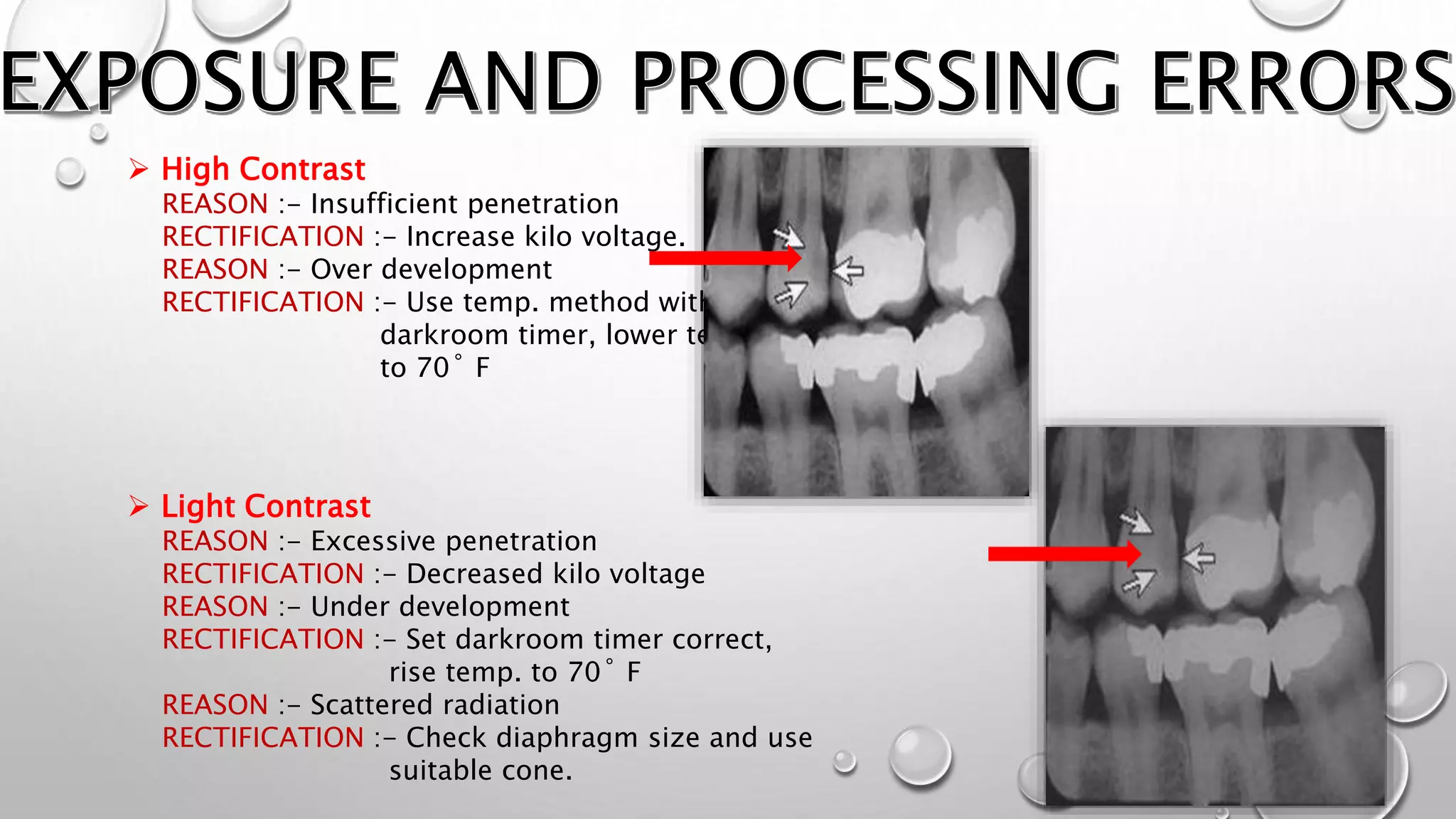 Faulty Radiographs | PPTX