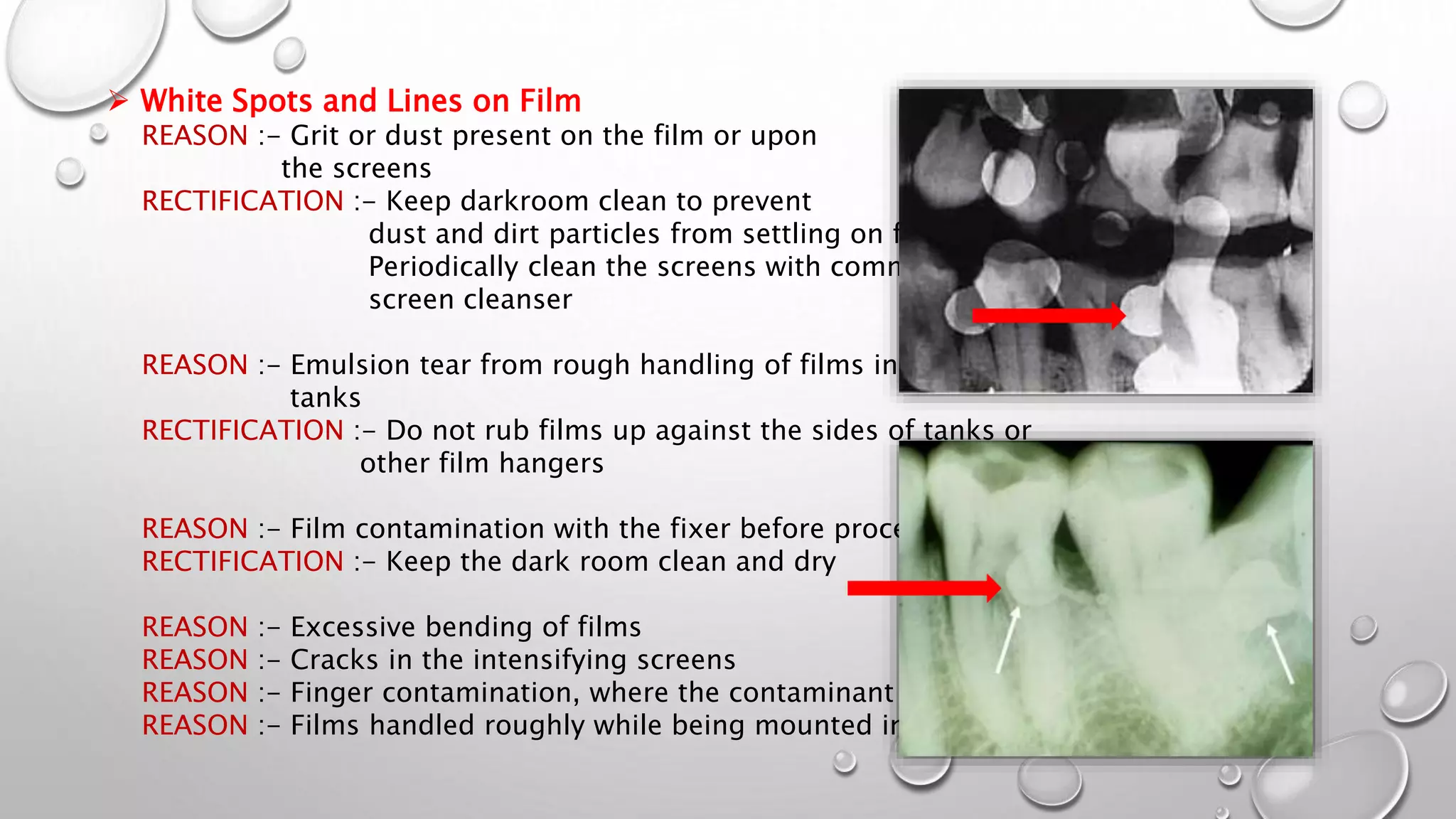 Faulty Radiographs | PPTX