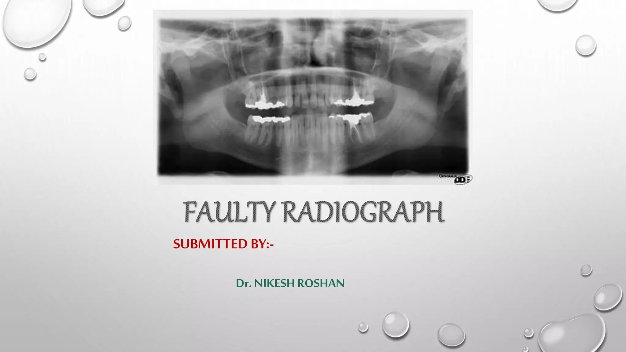 Faulty Radiographs | PPTX