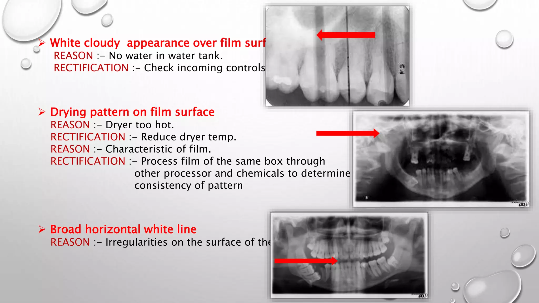Faulty Radiographs | PPTX