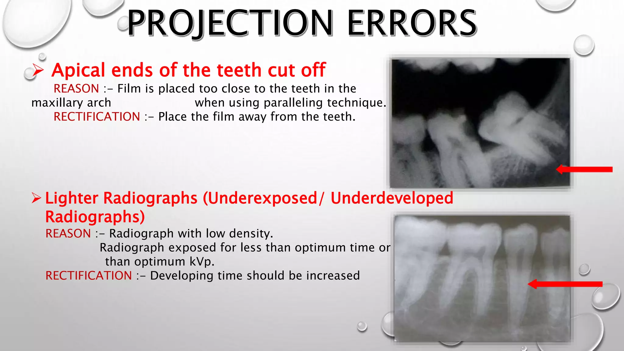 Faulty Radiographs | PPTX