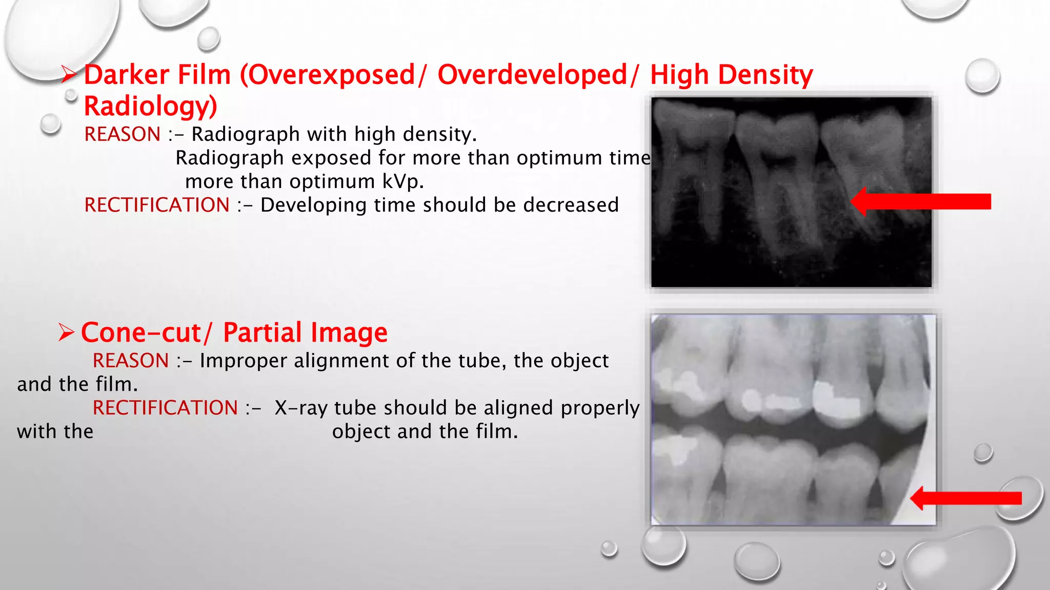 Faulty Radiographs | PPTX