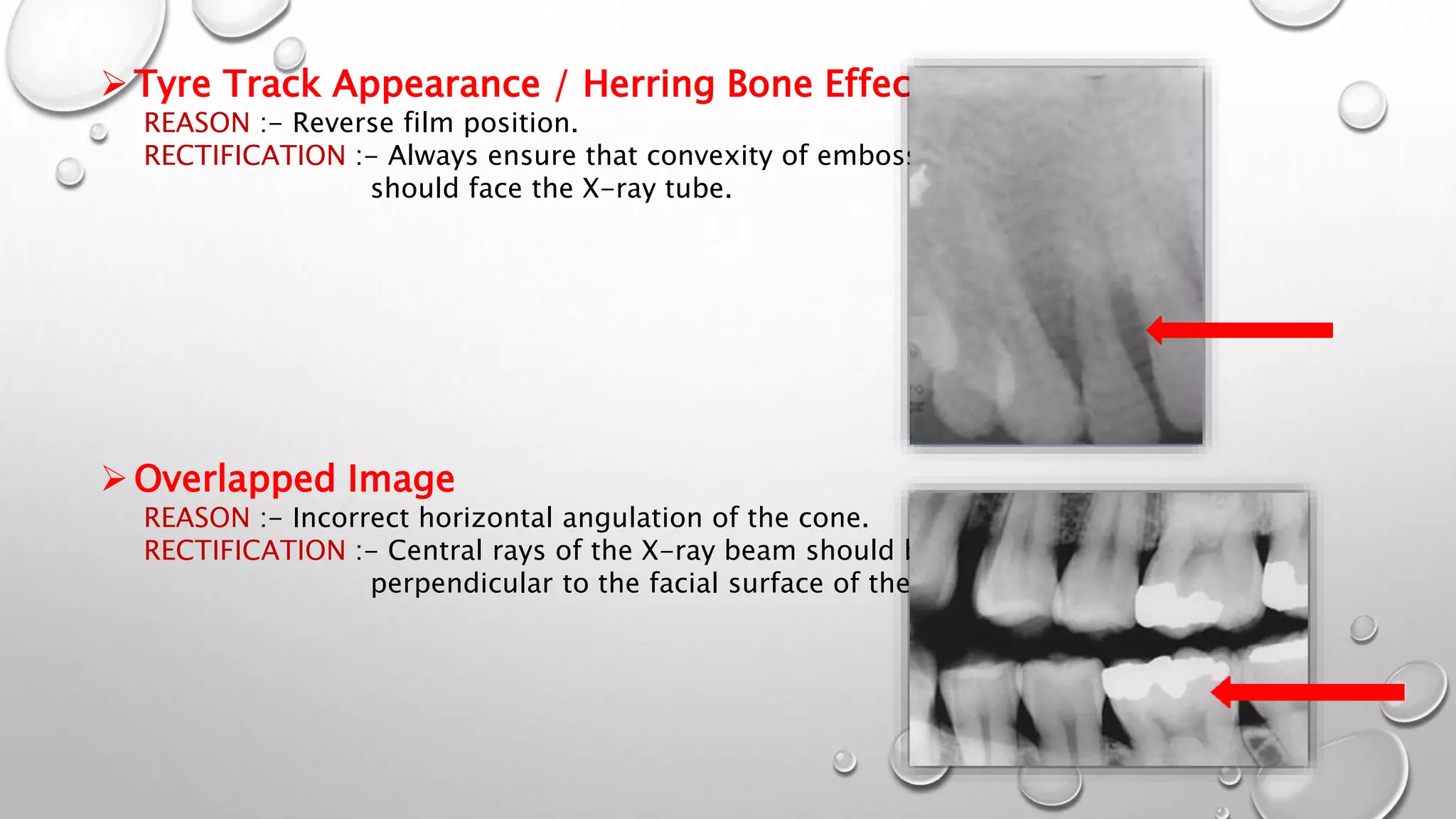 Faulty Radiographs | PPTX