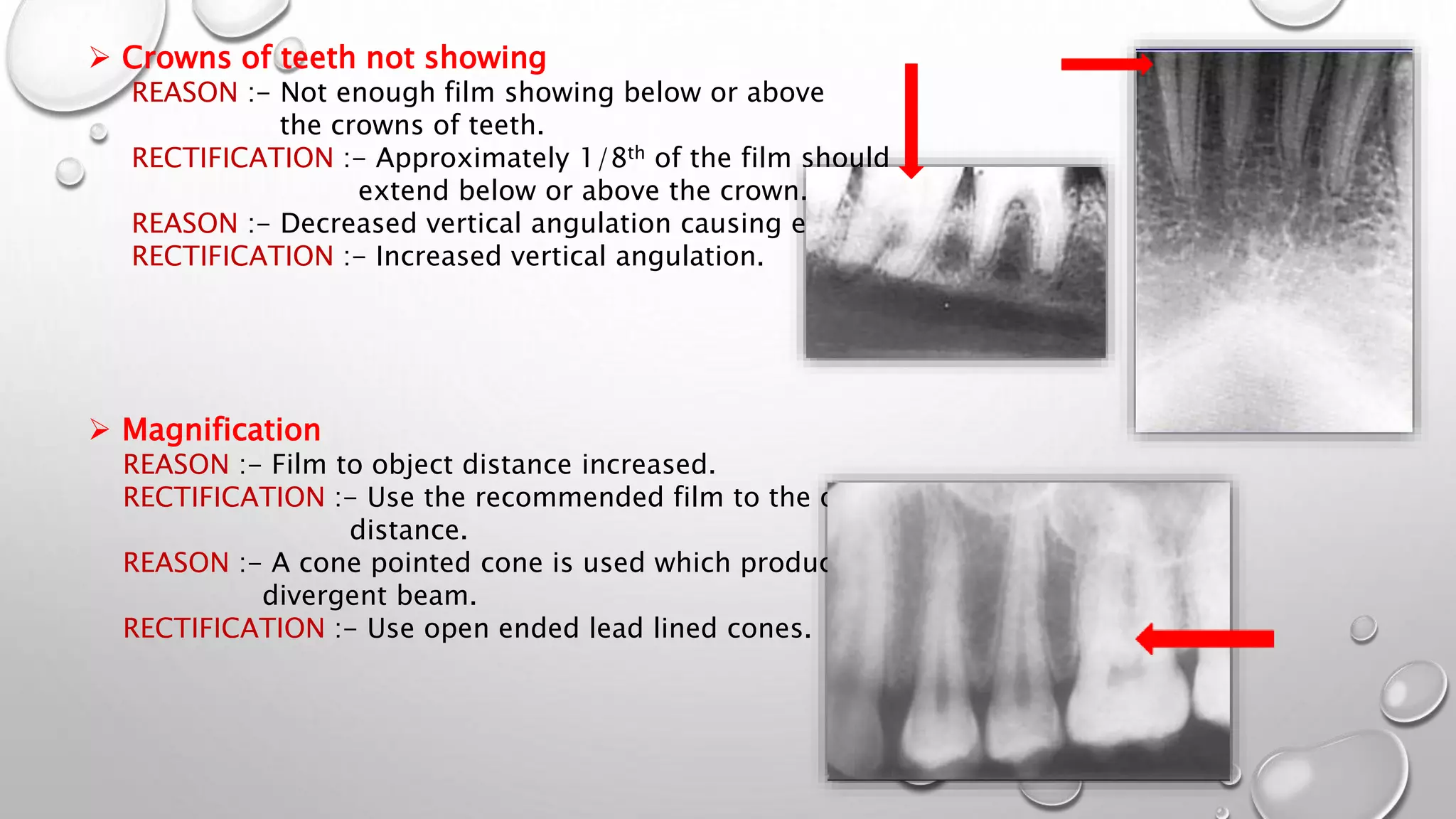 Faulty Radiographs | PPTX