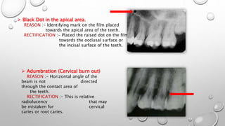 Faulty Radiographs | PPTX