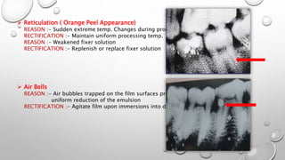 Faulty Radiographs | PPTX