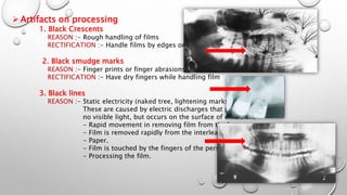 Faulty Radiographs | PPTX