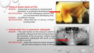 Faulty Radiographs | PPTX