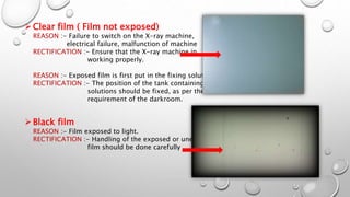 Faulty Radiographs | PPTX