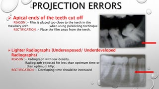 Faulty Radiographs | PPTX