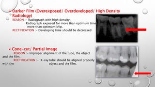 Faulty Radiographs | PPTX