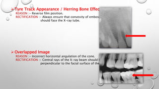 Faulty Radiographs | PPTX