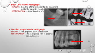 Faulty Radiographs | PPTX