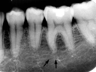 NORMAL RADIOGRAPHIC LANDMARKS | PPTX