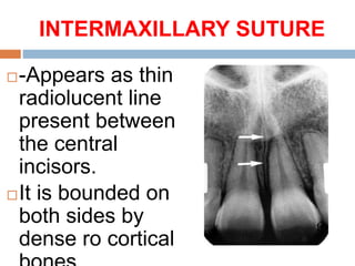 NORMAL RADIOGRAPHIC LANDMARKS | PPTX