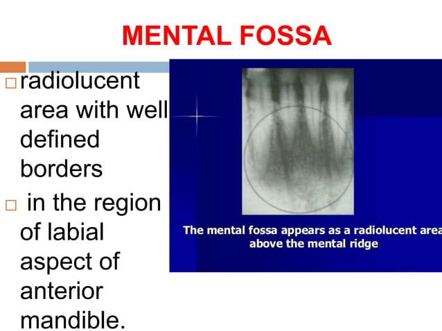 NORMAL RADIOGRAPHIC LANDMARKS | PPTX