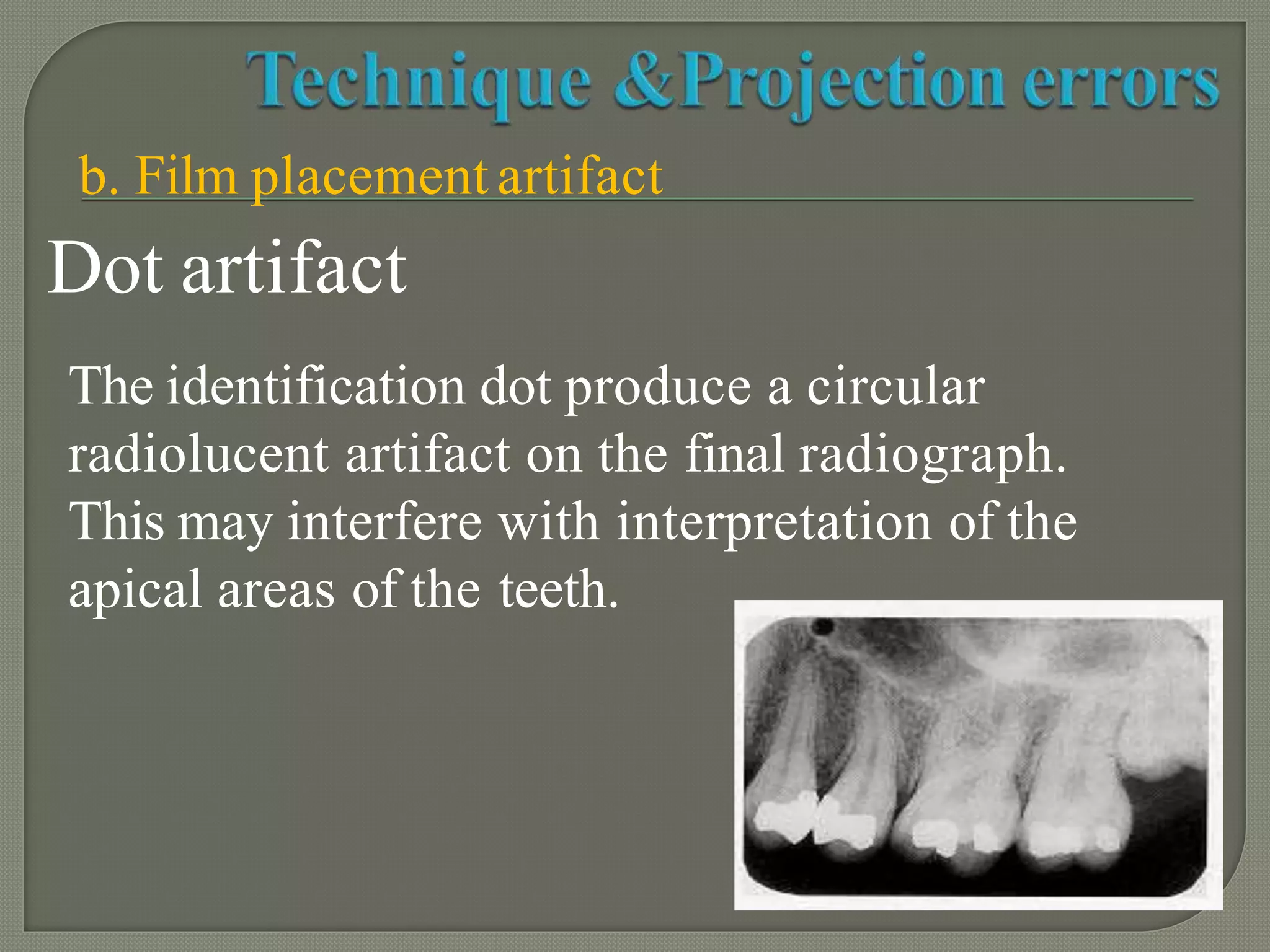 RADIOGRAPHIC ARTIFACTS | PPTX