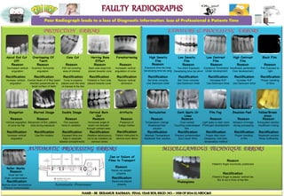 FAULTY RADIOGRAPHS IN IOPAR | PPTX