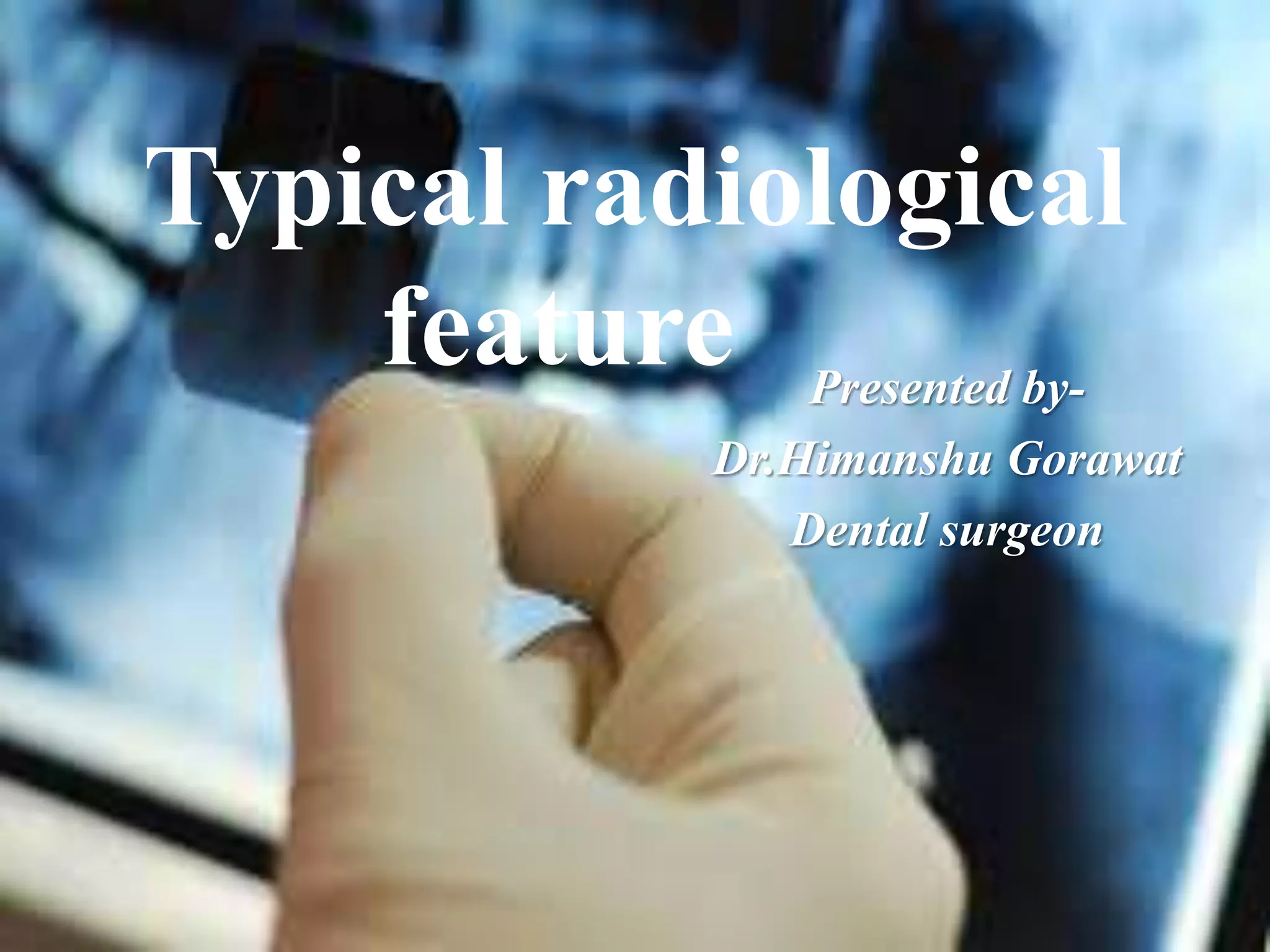 Typical radiological feature | PPTX