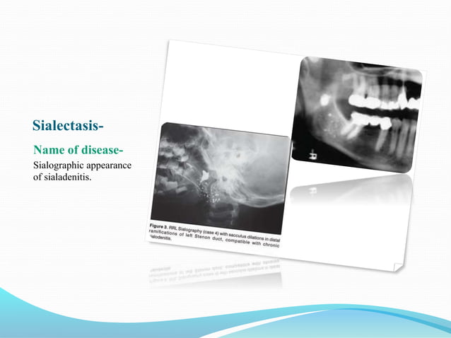 Typical radiological feature | PPTX