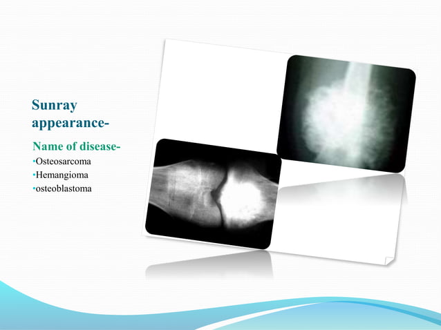 Typical radiological feature | PPTX