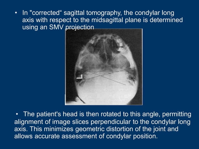 Imaging of tmj in dental radiography and advanced technologies in ...