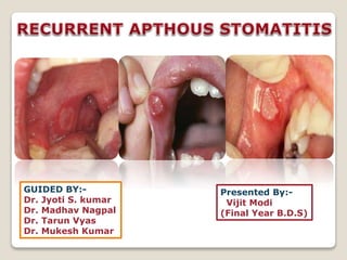 recurrent apthous ulcer | PPTX
