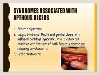 recurrent apthous ulcer | PPTX