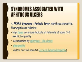 recurrent apthous ulcer | PPTX