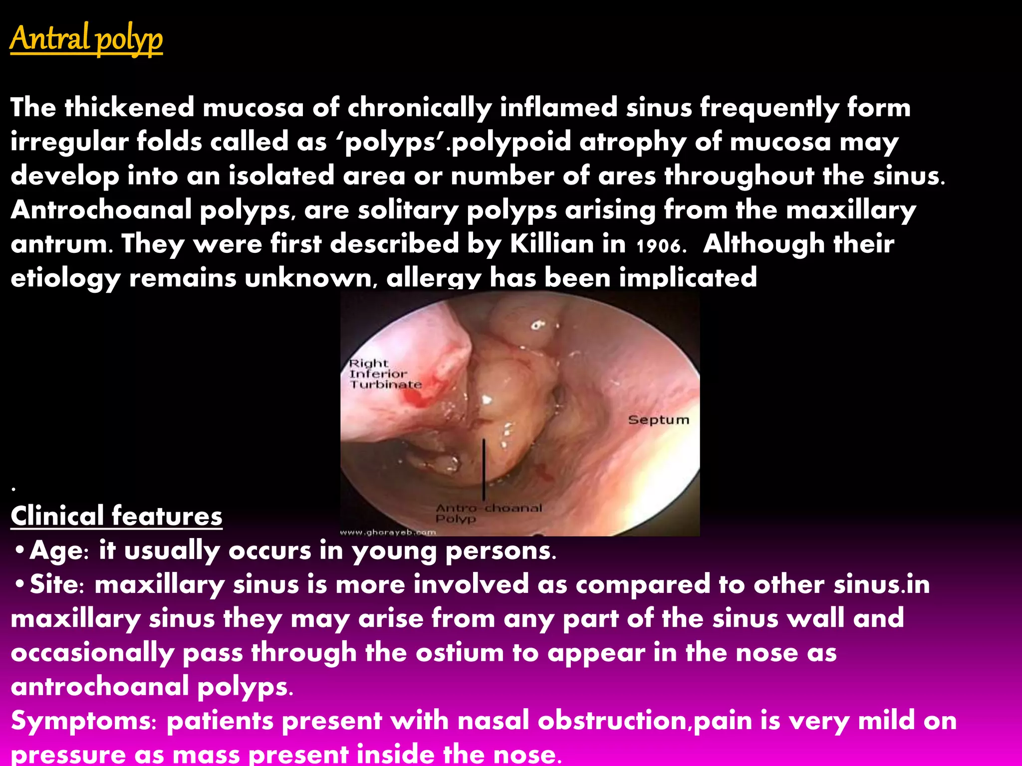 Differential Diagnosis Of Maxillary Sinus Pathology | PPTX