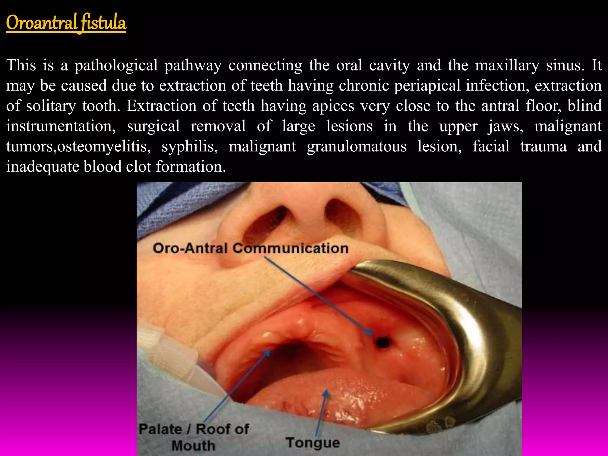 Differential Diagnosis Of Maxillary Sinus Pathology | PPTX