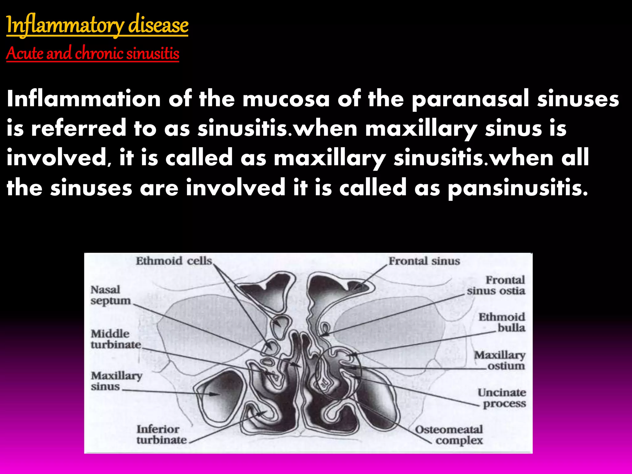 Differential Diagnosis Of Maxillary Sinus Pathology | PPTX