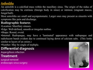 Differential Diagnosis Of Maxillary Sinus Pathology | PPTX
