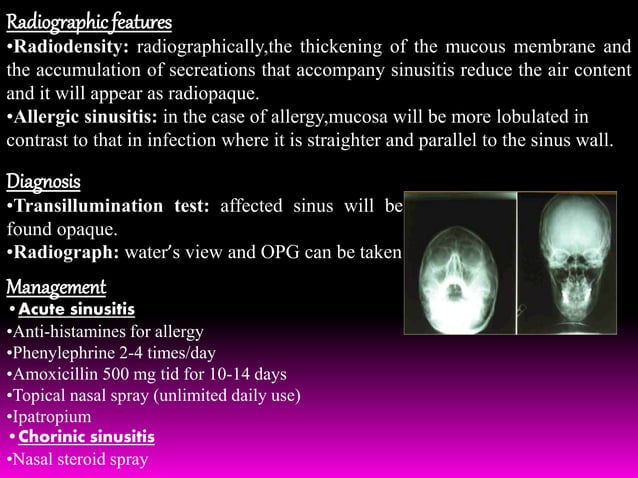 Differential Diagnosis Of Maxillary Sinus Pathology